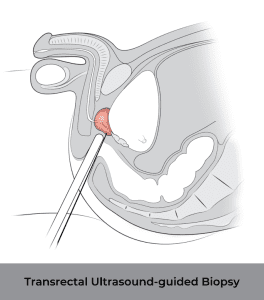 Promaxo MRI | Beverly Hills Urology - Promaxo MRI - Beverly Hills ...